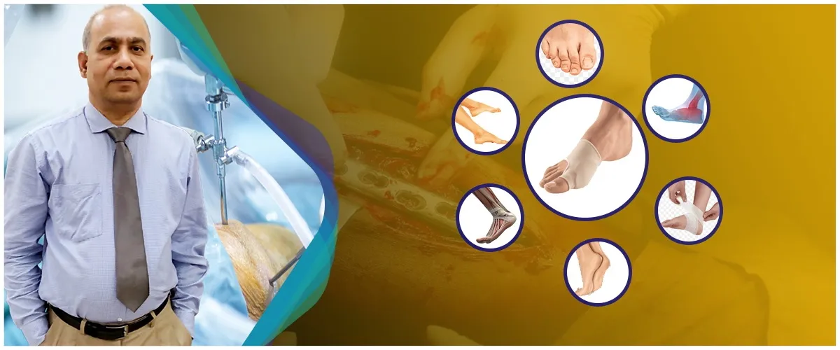 Clinical Specialist of Foot and Ankle in Bangladesh